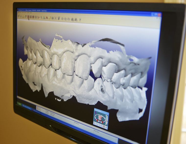 Welcome to the Age of Advanced Dental Imaging | Atlanta, GA